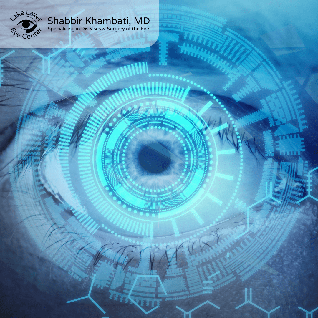 How Artificial Intelligence is Transforming LASIK and SMILE Pro for ...